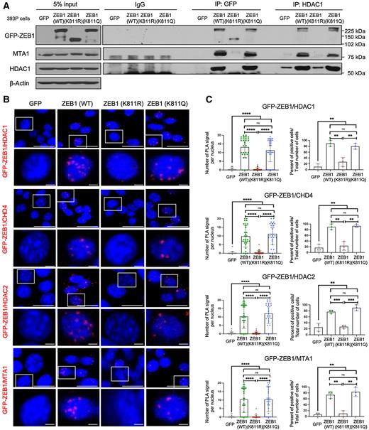 ZEB1 Is Regulated by K811 Acetylation to Promote Stability, NuRD ...