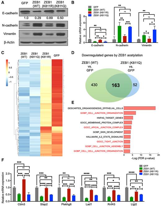 ZEB1 Is Regulated by K811 Acetylation to Promote Stability, NuRD ...