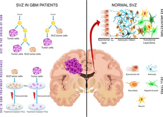 Dissecting Intra-tumor Heterogeneity in the Glioblastoma ...