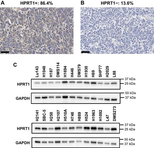 Metabolic Hallmarks for Purine Nucleotide Biosynthesis in Small Cell ...