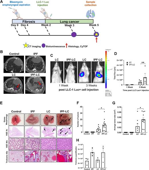 Modeling Molecular Pathogenesis of Idiopathic Pulmonary Fibrosis ...