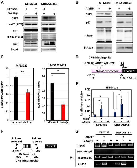 AIbZIP/CREB3L4 Promotes Cell Proliferation via the SKP2-p27 Axis in ...