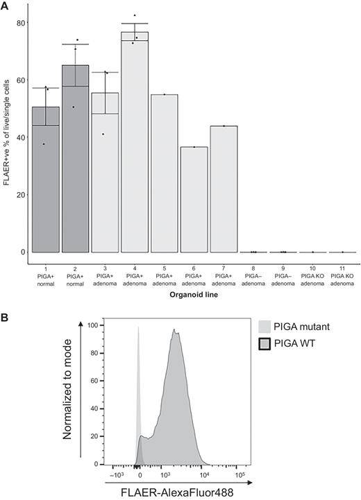 PIGA Mutations and Glycosylphosphatidylinositol Anchor Dysregulation in ...