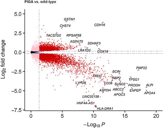 PIGA Mutations and Glycosylphosphatidylinositol Anchor Dysregulation in ...