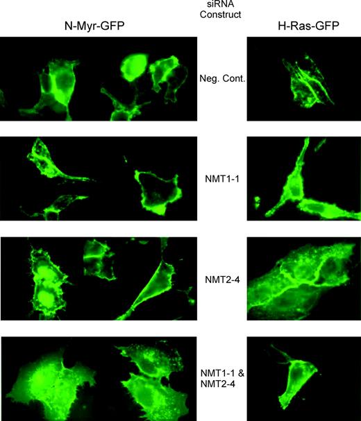 Two N-Myristoyltransferase Isozymes Play Unique Roles in Protein ...