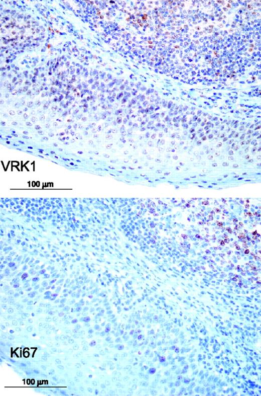 VRK1 Signaling Pathway in the Context of the Proliferation Phenotype in ...