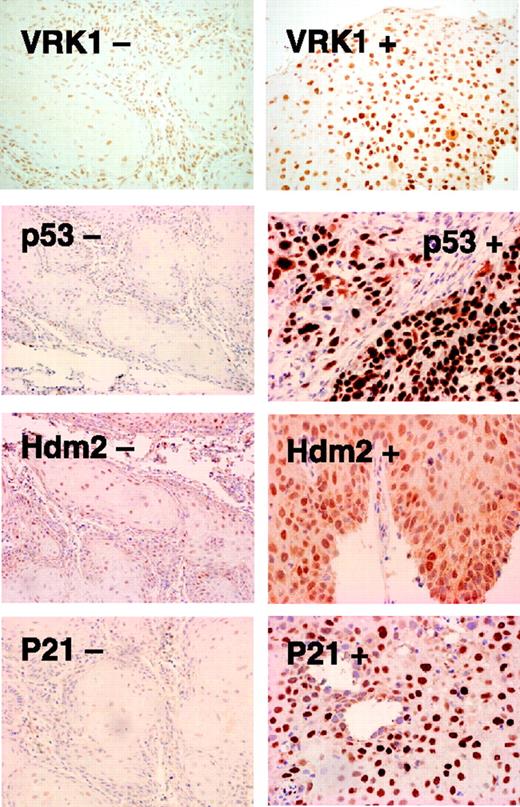 VRK1 Signaling Pathway in the Context of the Proliferation Phenotype in ...