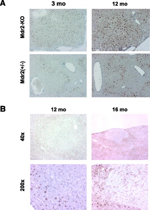 Molecular Mechanisms of Liver Carcinogenesis in the Mdr2-Knockout Mice ...