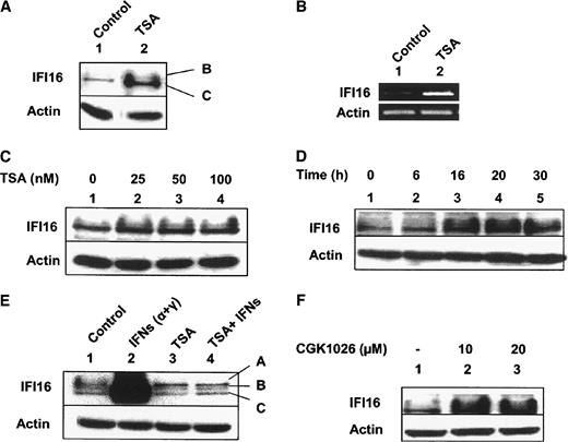 IFI16 in Human Prostate Cancer | Molecular Cancer Research | American ...