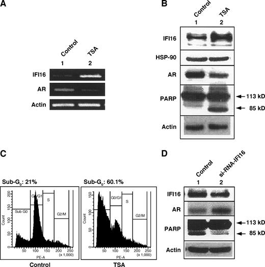 IFI16 in Human Prostate Cancer | Molecular Cancer Research | American ...