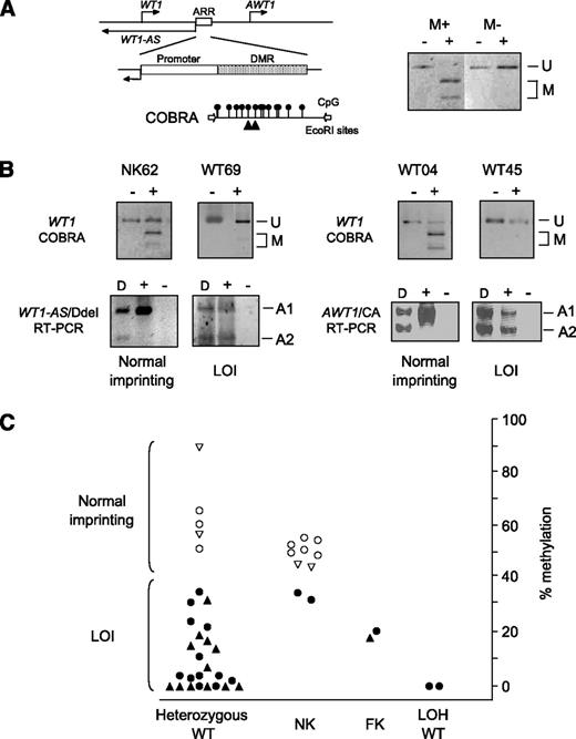Frequency and Timing of Loss of Imprinting at 11p13 and 11p15 in Wilms ...