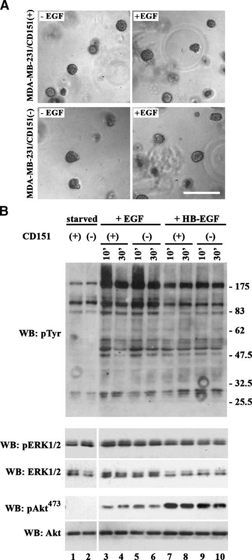 CD151 Regulates Tumorigenesis by Modulating the Communication between ...