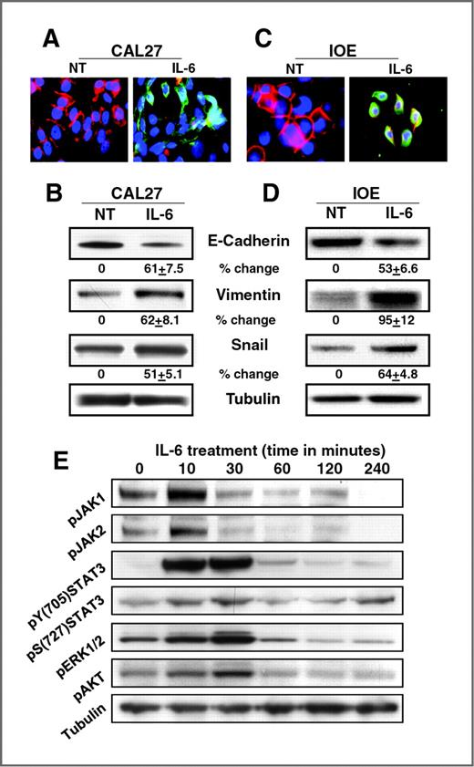 IL-6 Promotes Head and Neck Tumor Metastasis by Inducing Epithelial ...