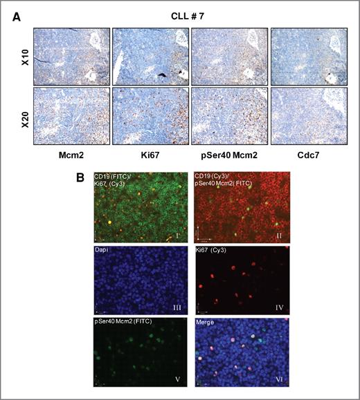 Mechanisms of Action of a Dual Cdc7/Cdk9 Kinase Inhibitor against ...