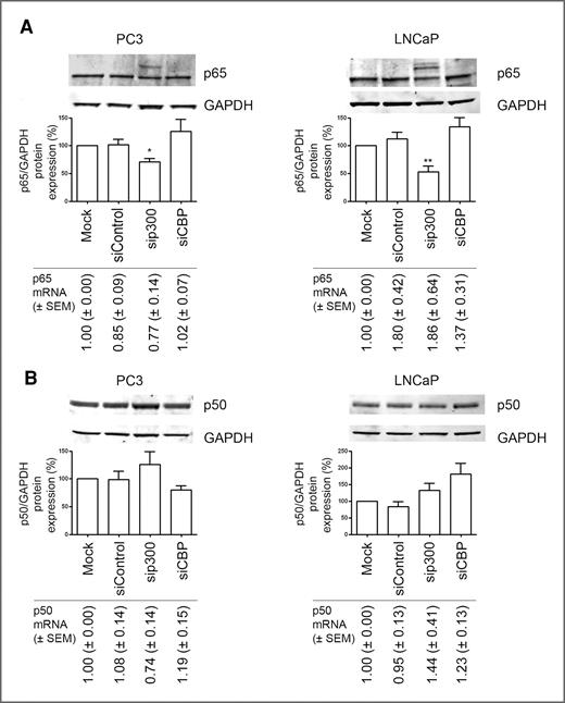 Inhibition of the Acetyltransferases p300 and CBP Reveals a Targetable ...