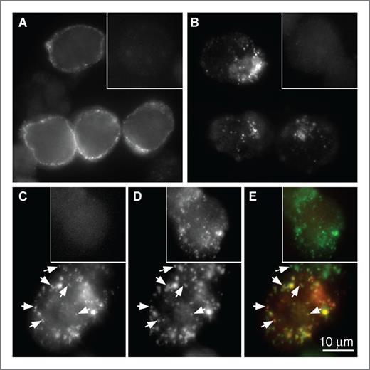 FcRL5 as a Target of Antibody–Drug Conjugates for the Treatment of ...