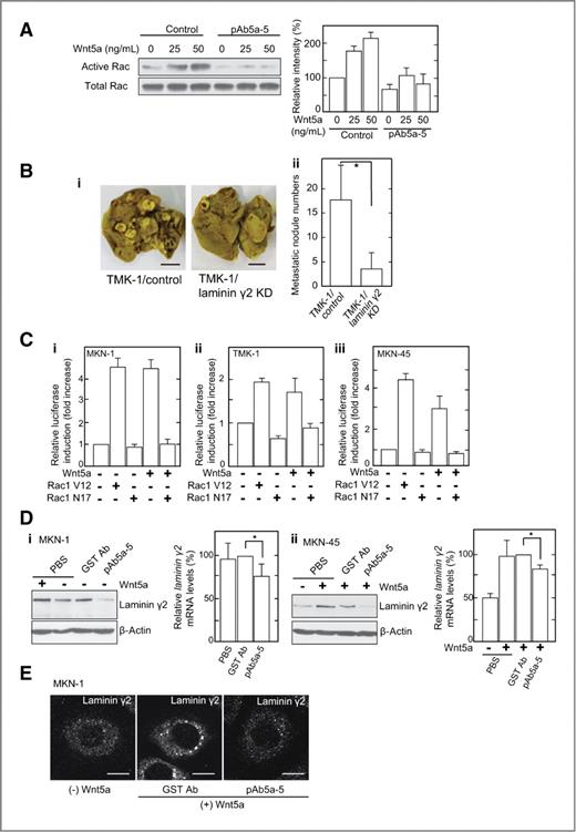 An Anti-Wnt5a Antibody Suppresses Metastasis of Gastric Cancer Cells In ...