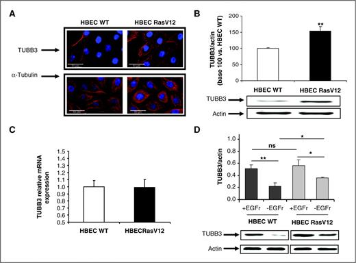 High TUBB3 Expression, an Independent Prognostic Marker in Patients ...