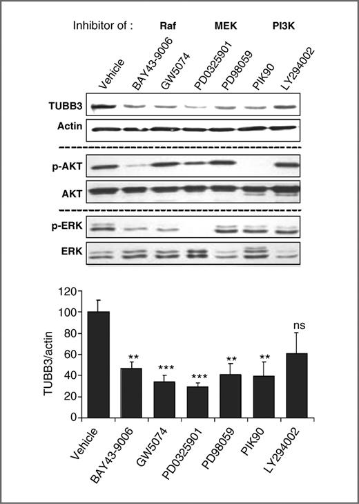 High TUBB3 Expression, an Independent Prognostic Marker in Patients ...