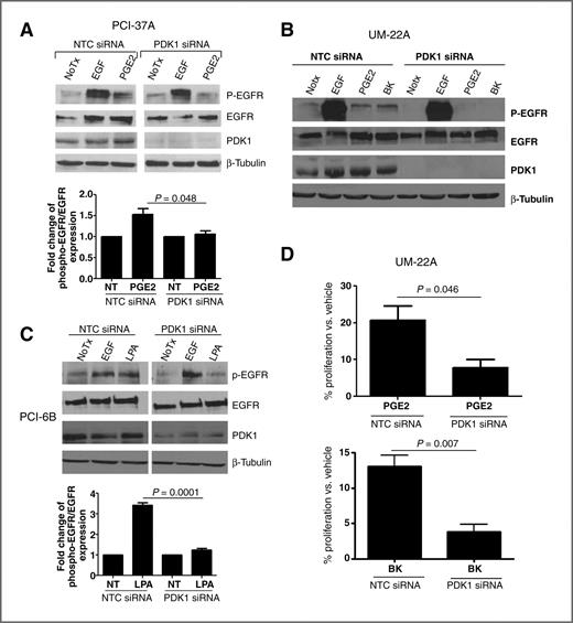 Antitumor Mechanisms of Targeting the PDK1 Pathway in Head and Neck ...