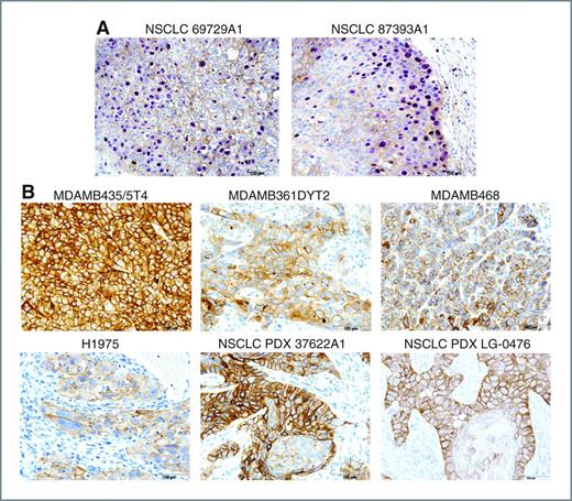 Long-term Tumor Regression Induced by an Antibody–Drug Conjugate That ...