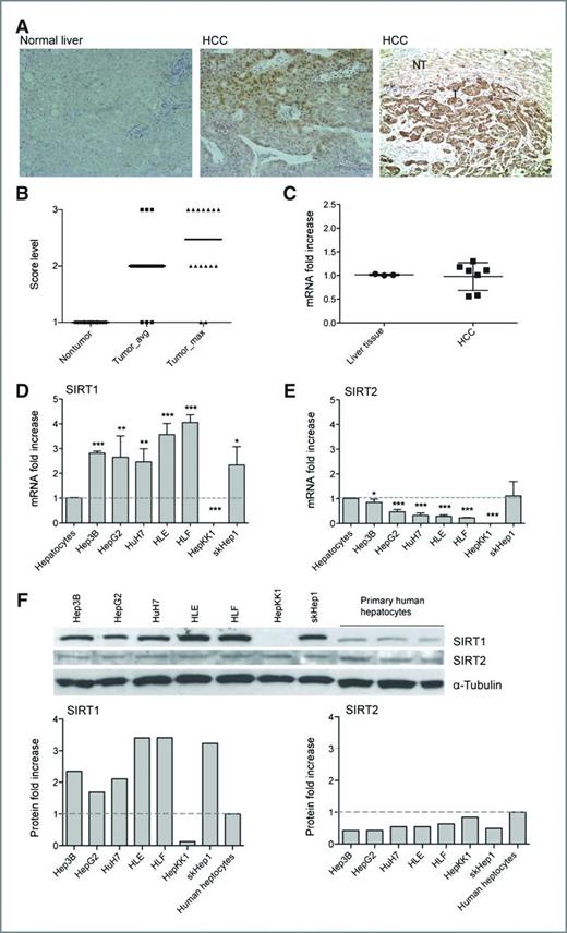 Antitumor Effect of SIRT1 Inhibition in Human HCC Tumor Models In Vitro ...
