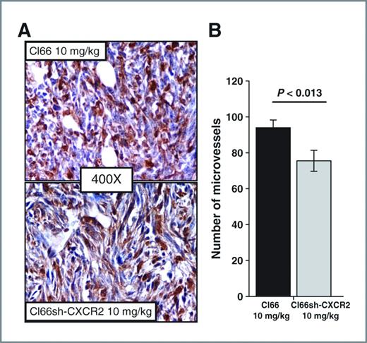 Targeting CXCR2 Enhances Chemotherapeutic Response, Inhibits Mammary ...