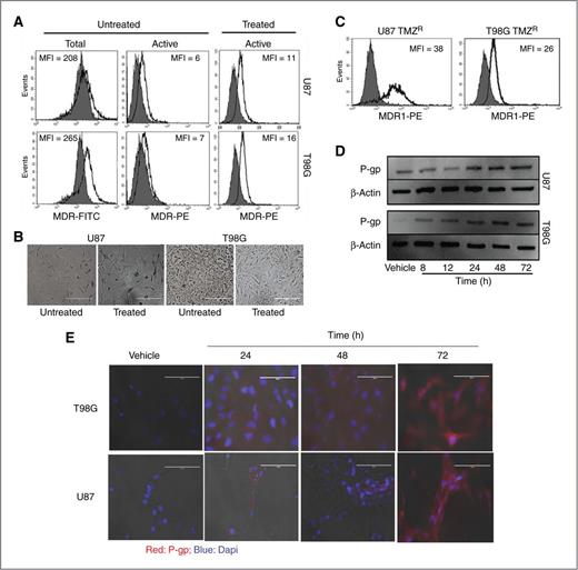 Temozolomide Induces the Production of Epidermal Growth Factor to ...
