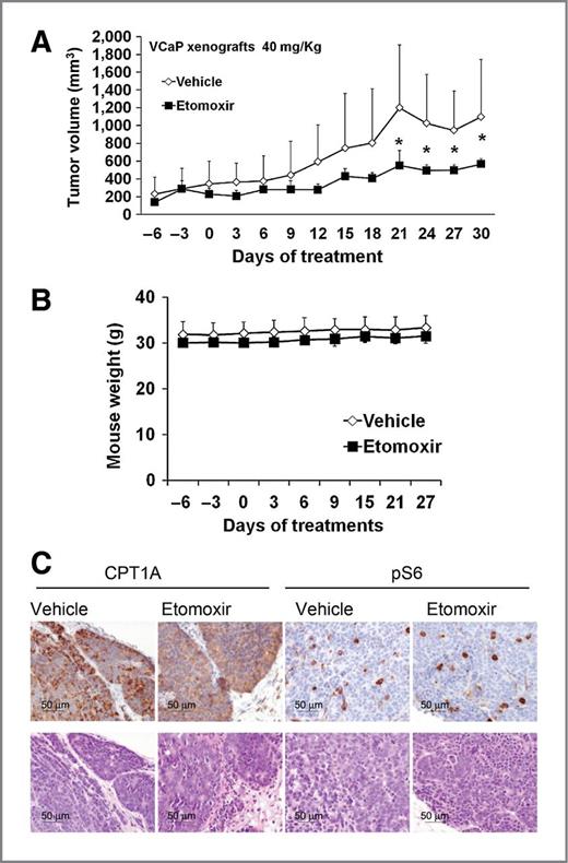 Lipid Catabolism via CPT1 as a Therapeutic Target for Prostate Cancer ...