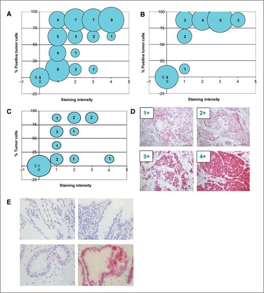 SGN–LIV1A: A Novel Antibody–Drug Conjugate Targeting LIV-1 for the ...