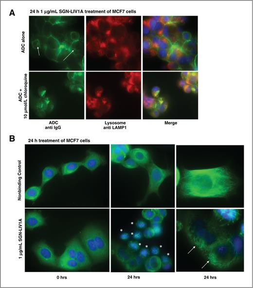 SGN–LIV1A: A Novel Antibody–Drug Conjugate Targeting LIV-1 for the ...