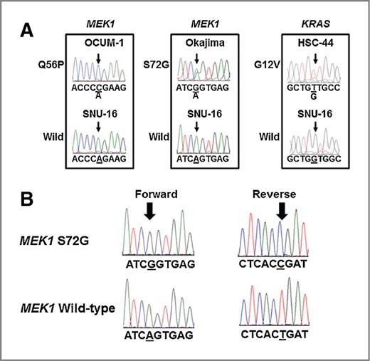 MEK Inhibitor for Gastric Cancer with MEK1 Gene Mutations | Molecular ...