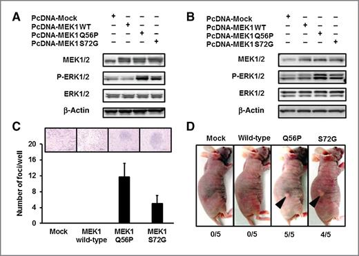 MEK Inhibitor for Gastric Cancer with MEK1 Gene Mutations | Molecular ...