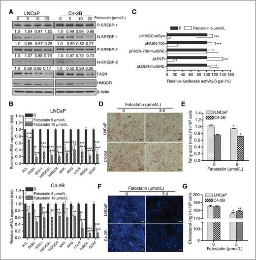 Fatostatin Displays High Antitumor Activity in Prostate Cancer by ...