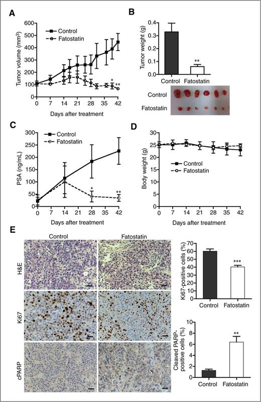 Fatostatin Displays High Antitumor Activity in Prostate Cancer by ...