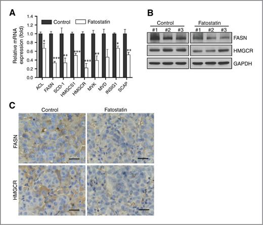 Fatostatin Displays High Antitumor Activity in Prostate Cancer by ...