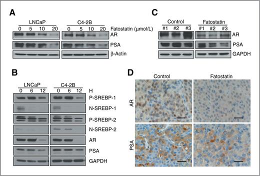 Fatostatin Displays High Antitumor Activity in Prostate Cancer by ...