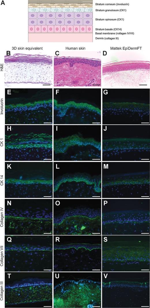 A Novel Fully Humanized 3D Skin Equivalent to Model Early Melanoma ...