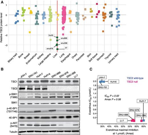 Loss of Tuberous Sclerosis Complex 2 (TSC2) Is Frequent in ...