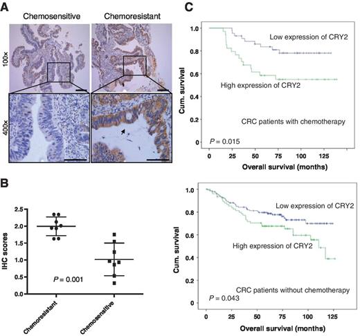 Circadian Clock Gene CRY2 Degradation Is Involved in Chemoresistance of ...
