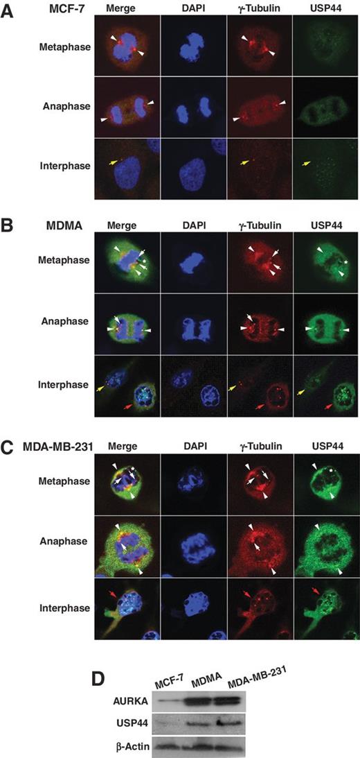 USP44+ Cancer Stem Cell Subclones Contribute to Breast Cancer ...