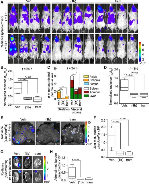 Development of a RSK Inhibitor as a Novel Therapy for Triple-Negative ...