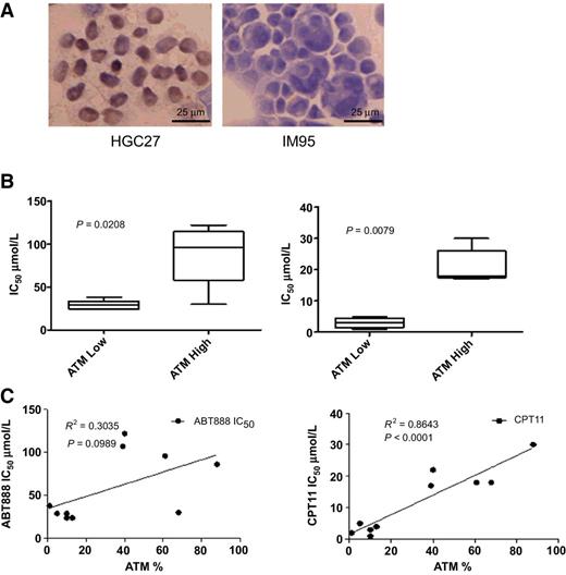 ATM Expression Predicts Veliparib and Irinotecan Sensitivity in Gastric ...
