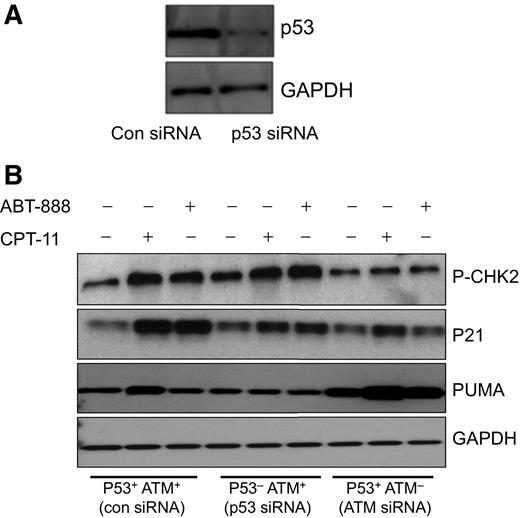 ATM Expression Predicts Veliparib and Irinotecan Sensitivity in Gastric ...