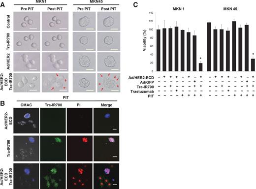 Trastuzumab-Based Photoimmunotherapy Integrated with Viral HER2 ...