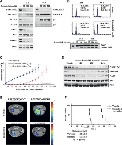 Entrectinib, a Pan–TRK, ROS1, and ALK Inhibitor with Activity in ...