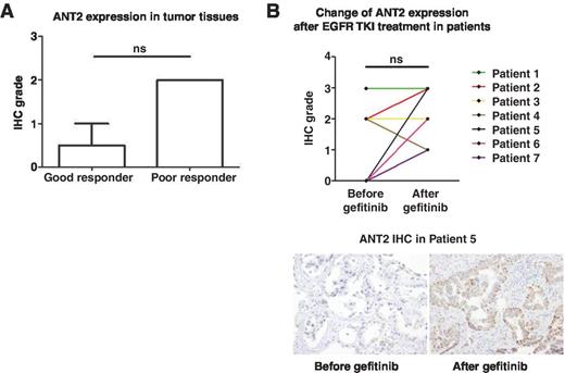 Targeting Adenine Nucleotide Translocase-2 (ANT2) to Overcome ...