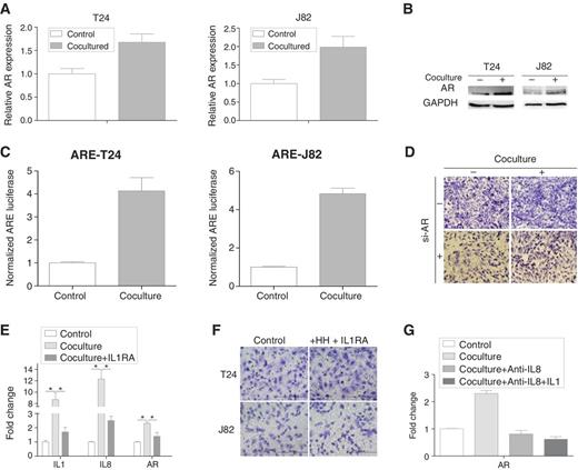 Infiltrating T Cells Promote Bladder Cancer Progression via Increasing ...