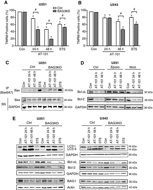 Interference with the HSF1/HSP70/BAG3 Pathway Primes Glioma Cells to ...