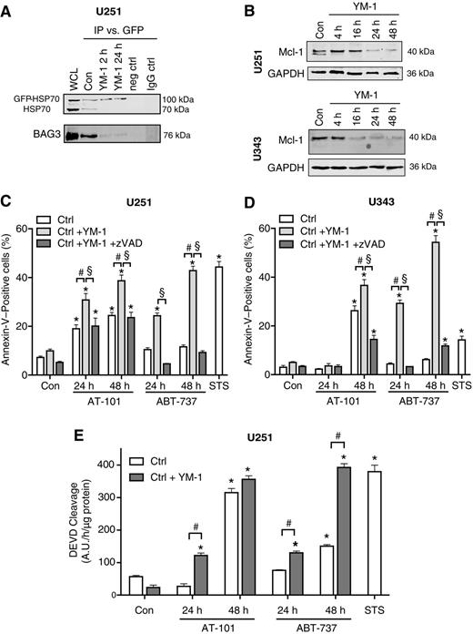 Interference with the HSF1/HSP70/BAG3 Pathway Primes Glioma Cells to ...
